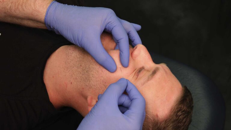 Myopain Seminars | Programs for Dry Needling and Manual Therapy Courses